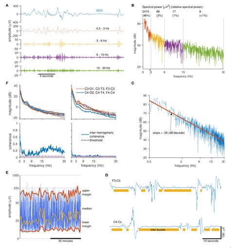 Figure 1 From Quantitative Preterm Eeg Analysis The Need For Caution In Using Modern Data