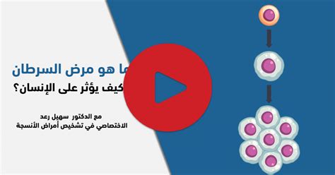 ما هو مرض السرطان وكيف يؤثر على الإنسان؟