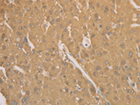 兔抗cd40多克隆抗体anti Cd40 Rabbit Polyclonal Antibody 生命科学产品与技术服务 生工生物工程上海