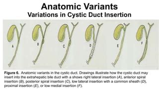 Cystic Duct Normal Anatomy And Anatomic Variantspptx