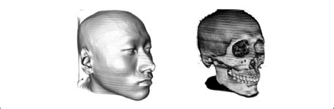 Direct Volume Rendering 3d Visualization Of The Ge Ct Data With Amira