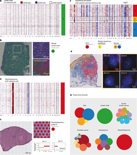 Somatic Copy Number Alterations In Cancer And Benign Histologies Ab Download Scientific