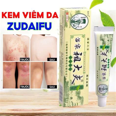 Zudaifu Itchy Fungus Cream Helps Eliminate Ringworm Scabies Scalp