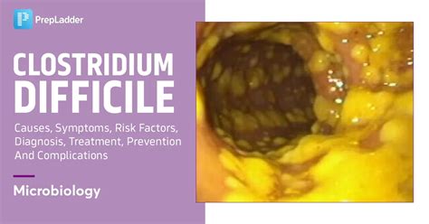 C Diff Stool Frontiers The Value Of Fecal Calprotectin In