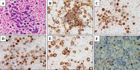 Histopathology And Immunohistochemical Findings A Hematoxylin Eosin