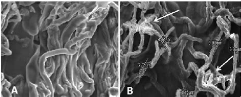 Scanning Electron Micrographs Of Interaction Between Rhizoctonia