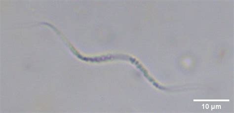 Monoraphidium Irregulare · Inaturalist Monoraphidium Irregulare · Inaturalist