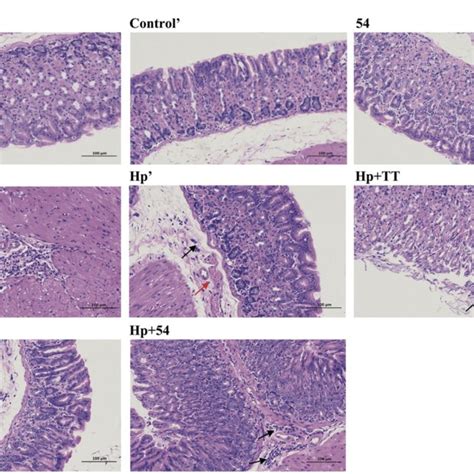 Figure Hematoxylin Eosin Staining Of The Gastric Tissues Control Download Scientific Diagram