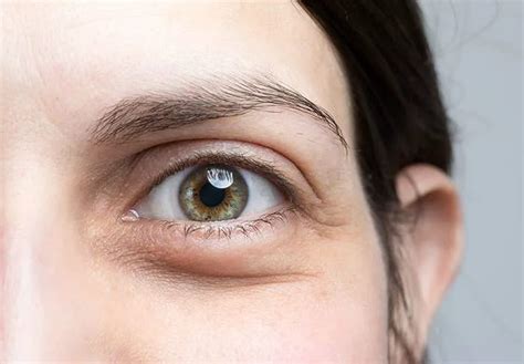 Skin Experts Tell Us The Worst Nighttime Habit That Causes Puffy Ey