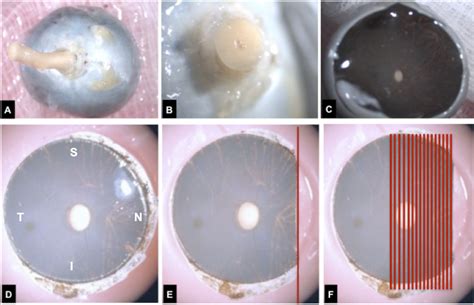 Optic Nerve Head Onh Tissue Processing For Ihc See The Methods Download Scientific Diagram