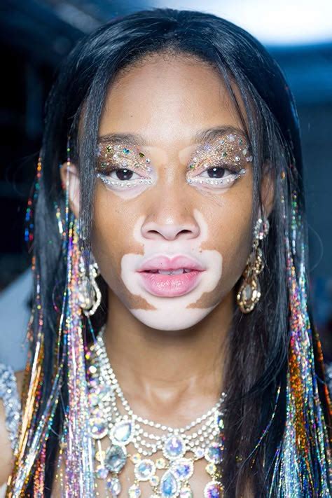 Winnie Harlow Breaking Barriers And Redefining Beauty