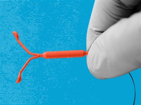 Mirena Iud Review And Information