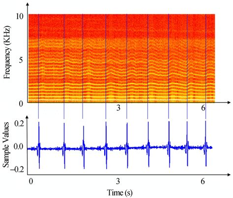 Spectrogram Of A Vowel Speech Signal And The Corresponding Ecg Signal Download Scientific