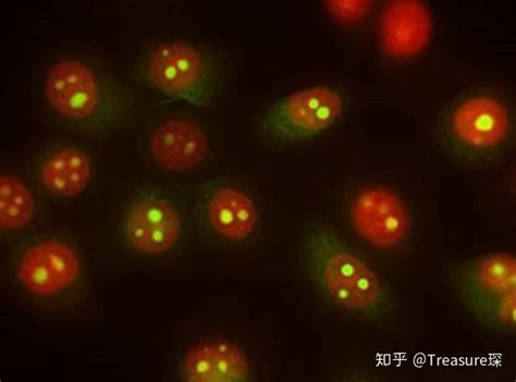 Imagej实用技巧——荧光共标细胞计数 解放双手篇 知乎
