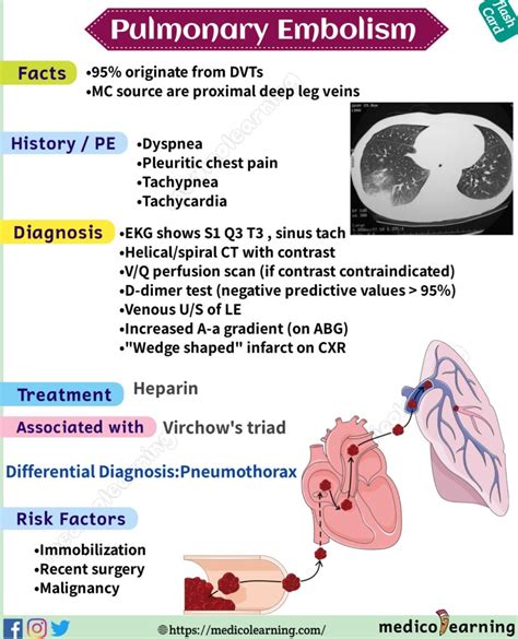 Pulmonary Embolism