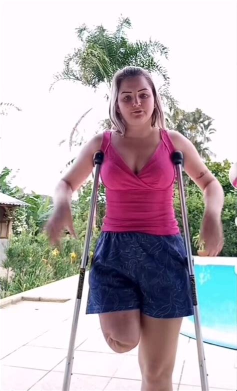 Amputee Women In Crutches Video 14