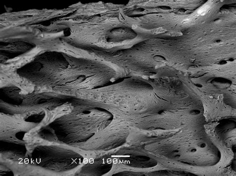 Bone Cells Under A Microscope