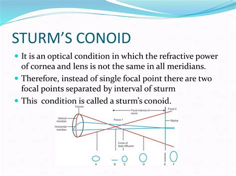 Sturms Conoid Pptx
