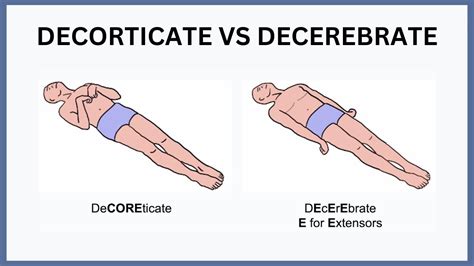 Decorticate Vs Decerebrate Explained Youtube