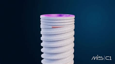 Dentsply Sirona On Linkedin Mis Make It Simple