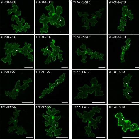 Co Localization Of Myosin Coiled Coils And Dcp1 In Arabidopsis Download Scientific Diagram