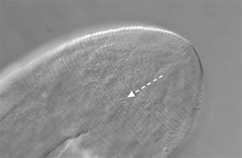 Love Bugs These Nipple Mites Have Sex On Your Face As You Sleep Sam