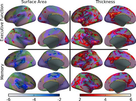 Bootstrap Ratios Across The Cortical Overlaid On The Color Coded