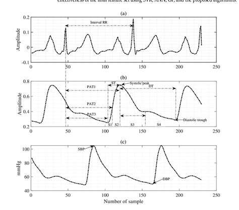 Features Extraction I From The Ppg With Ecg Signal Where A Is An Download Scientific