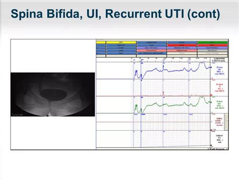 Urodynamic Studies For Neurogenic Bladder Pdf