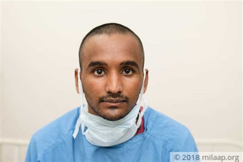 19 year old santhosh s cancer can claim his leg and even his milaap