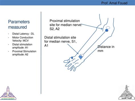 Clinical Neurophysiology Exploration Cne01 Ppt Download
