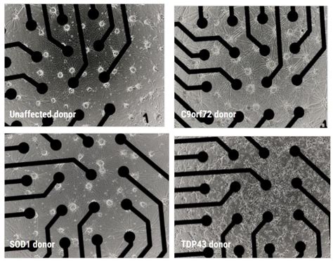 Multielectrode Array Characterization Of Human Ipsc Derived Motor Neuron Disease Model For Als
