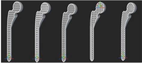 Tpms Lattice Structures In Hip Implant Download Scientific Diagram