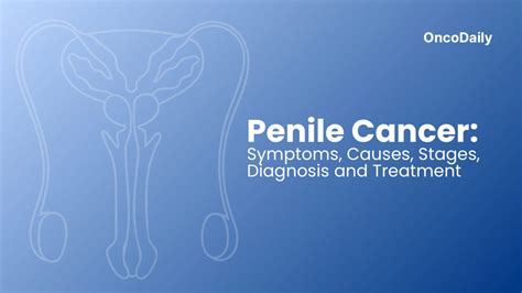 Penile Cancer Symptoms And Causes Stages Diagnosis And Treatment