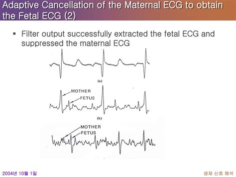 PPT ADAPTIVE FILTERS FOR REMOVAL OF INTERFERENCE PowerPoint Presentation ID