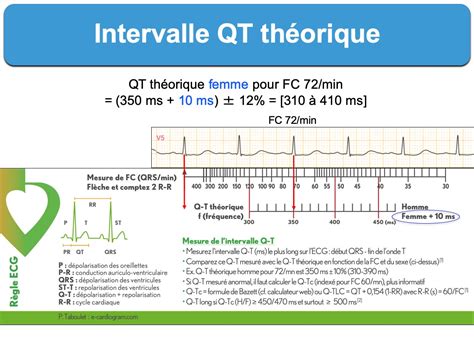 Intervalle QT 1 Mesure E Cardiogram