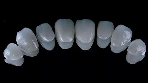 前牙美学修复美学极端美学第3页大山谷图库