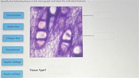 Identify The Following Tissue In The Micrograph And