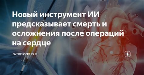 Новый инструмент ИИ предсказывает смерть и осложнения после операций на сердце Overclockers Ru
