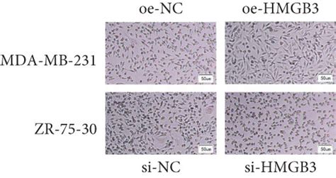 Altered Hmgb3 Expression Affects Bc Cell Proliferation Invasion