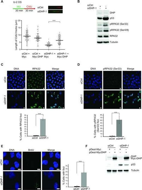 Suppression Of Dhp Interferes With Replication Fork Progression And Download Scientific Diagram