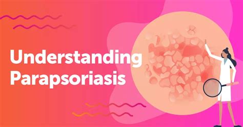 Parapsoriasis Treatment