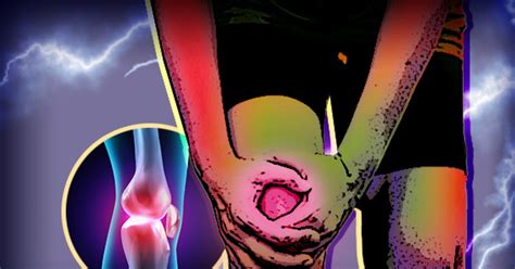 100세건강 노화로 생기는 무릎 관절염 이 자세는 피해야