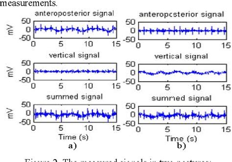 Figure 2 From Estimation Of Respiratory Waveform Using An Accelerometer