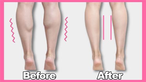 종아리 얇아지는 스트레칭 이것을 모르면 당신의 종아리는 더 두꺼워집니다 종아리 스트레칭 종아리 알 빼기 종아리 살이 안빠지는 이유 Youtube