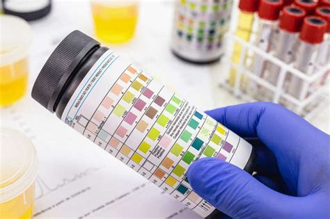 Whats The Best Synthetic Urine Kit For Drug Tests Urbanmatter