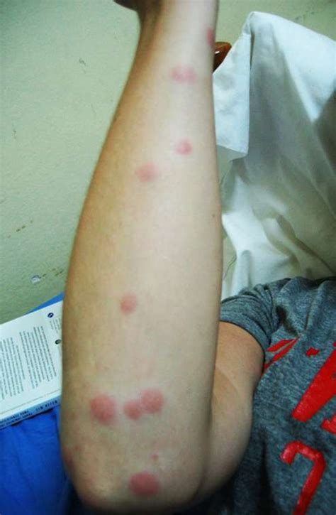 What All Do Termites Eat