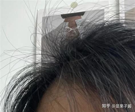 有什么好用的防脱洗发水推荐 知乎