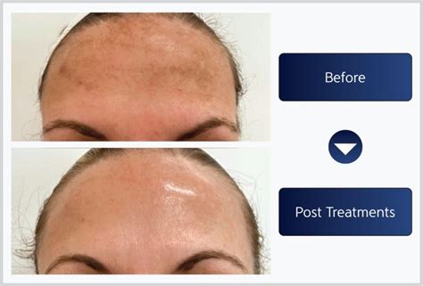 Evocyte Uk And Ireland On Linkedin Evocyte London Exosomes