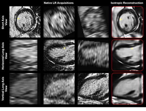 10 Example Of 3d Isotropic Reconstruction Results On A 20 Year Old Download Scientific Diagram